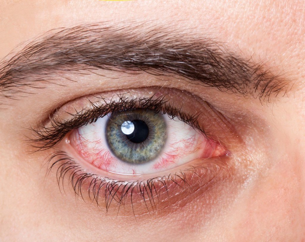 All You Need To Know About The Dry Eye Syndrome Itoozhi Ayurveda All You Need To Know About The Dry Eye Syndrome Itoozhi Ayurveda